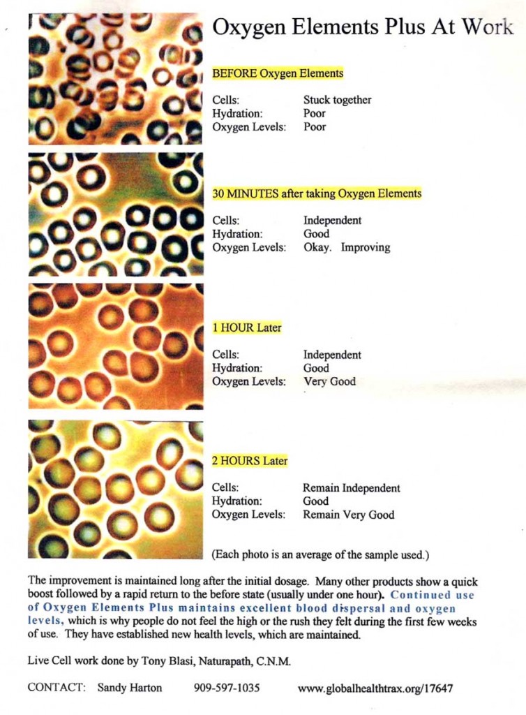 Oxygen Elements Uses Properties Schoolworkhelper